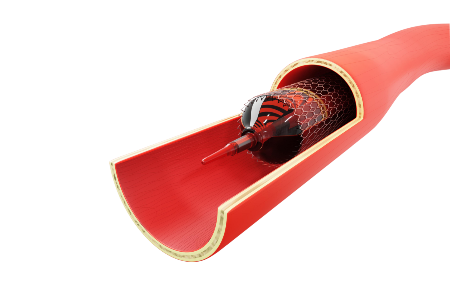 Resolution Medical - Medical Device Design and Manufacturing