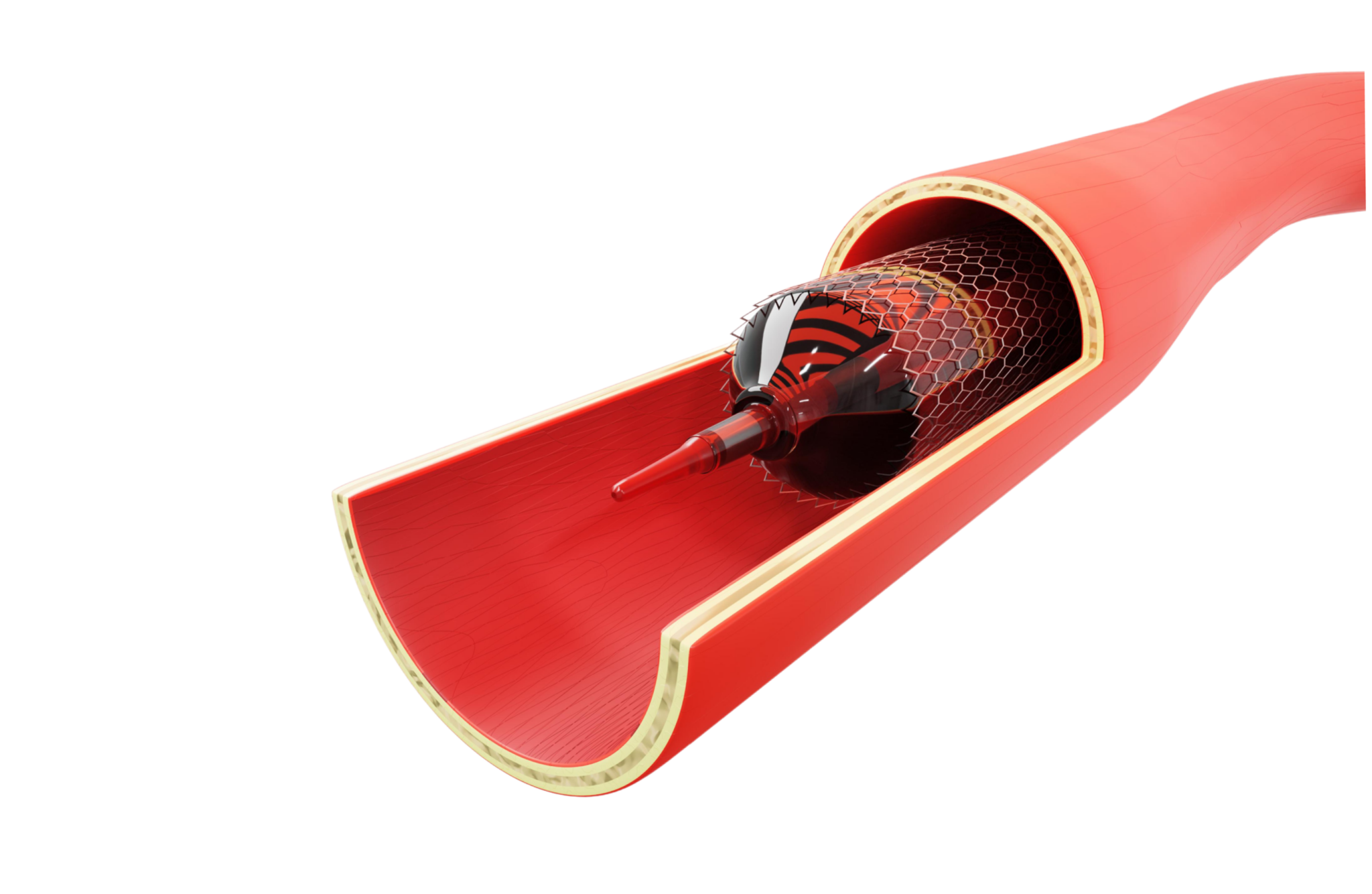 Resolution Medical - Medical Device Design and Manufacturing