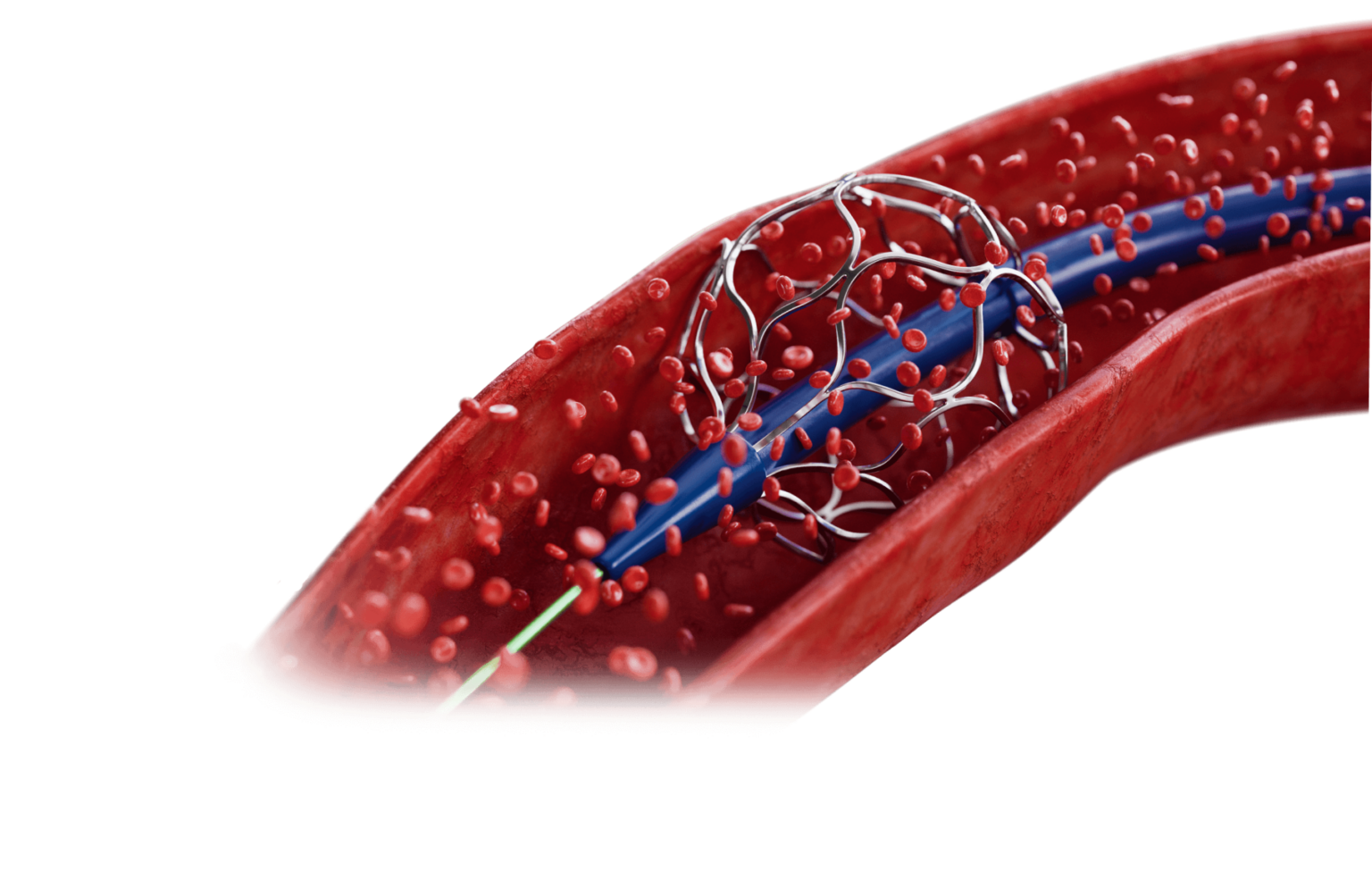 Resolution Medical - Medical Device Design and Manufacturing