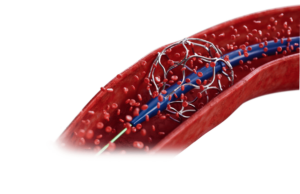 Resolution Medical - Medical Device Design and Manufacturing